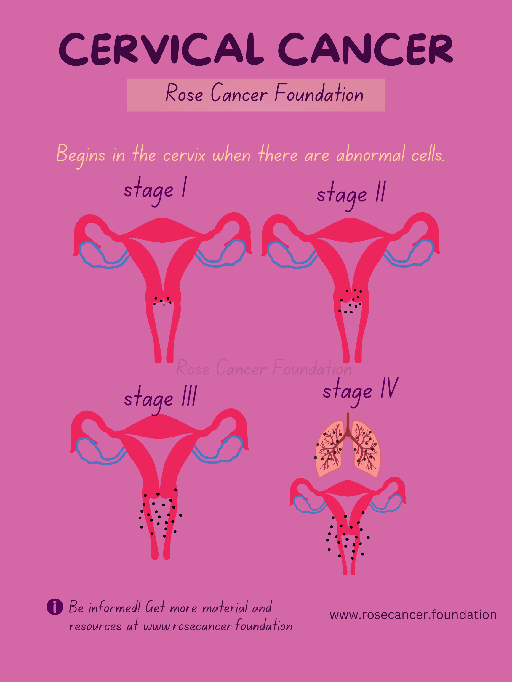 Cervical Cancer